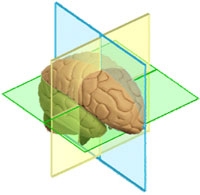 Life Kinetik - BrunnerCoaching